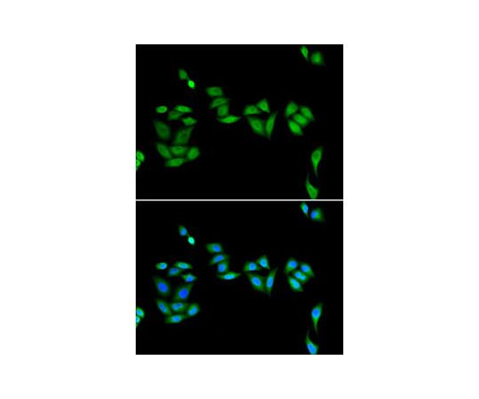 新着セール 64-2421-43 JADE1 Rabbit pAb 200uL A12579