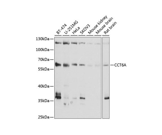 CCT6A Rabbit pAb A3589シリーズ ABclonal 【AXEL】 アズワン