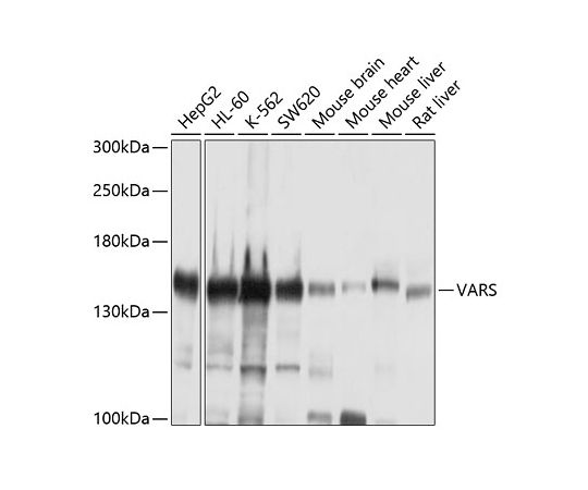 VARS Rabbit pAb A4182シリーズ ABclonal 【AXEL】 アズワン