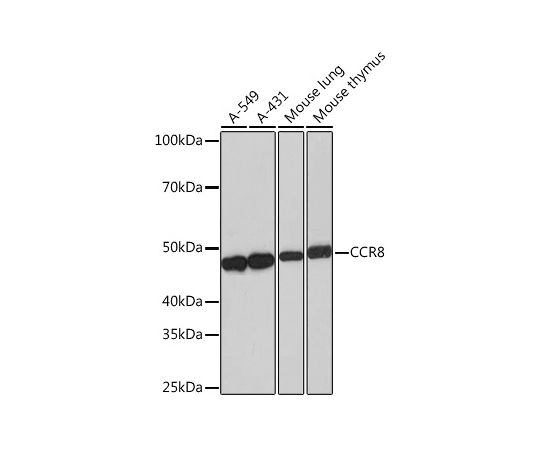 CCR8 Rabbit mAb A4288シリーズ ABclonal 【AXEL】 アズワン