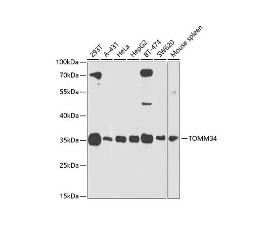 [取扱を終了した商品です]TOMM34 Rabbit pAb A4467シリーズ ABclonal 【AXEL】 アズワン