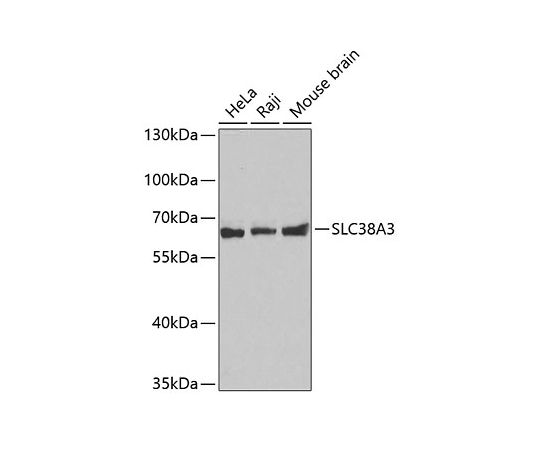 SLC38A3 Rabbit pAb A4472シリーズ ABclonal 【AXEL】 アズワン