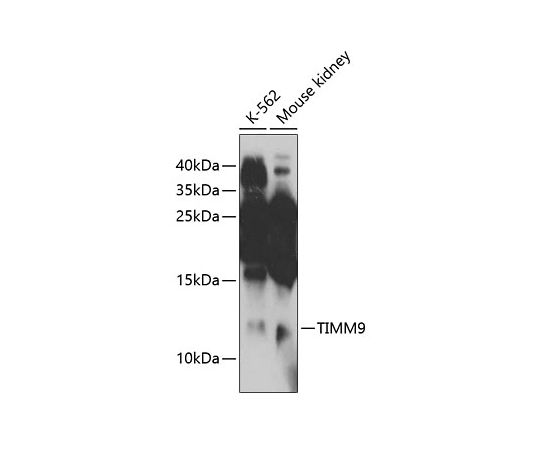 [取扱を終了した商品です]TIMM9 Rabbit pAb A4627シリーズ ABclonal 【AXEL】 アズワン