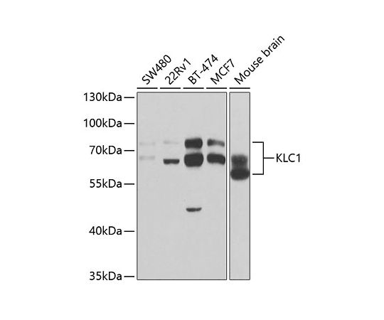 64-5533-01 Kinesin light chain 1 (KLC1) Rabbit pAb A5552 【AXEL】 アズワン