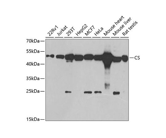 [取扱を終了した商品です]CS Rabbit pAb A5713シリーズ ABclonal 【AXEL】 アズワン