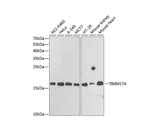 [取扱を終了した商品です]TIMM17A Rabbit pAb A6449シリーズ ABclonal 【AXEL】 アズワン