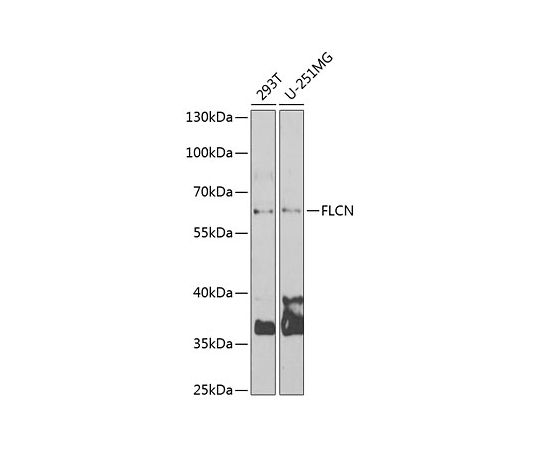 [取扱を終了した商品です]FLCN Rabbit pAb 200uL A6493 64-5560-96 【AXEL】 アズワン