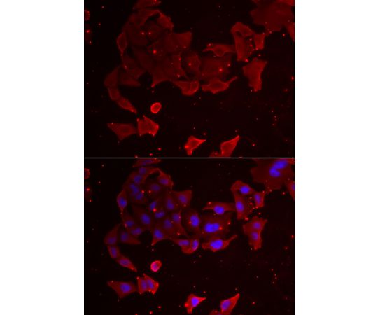 [取扱を終了した商品です]FLCN Rabbit pAb 200uL A6493 64-5560-96 【AXEL】 アズワン