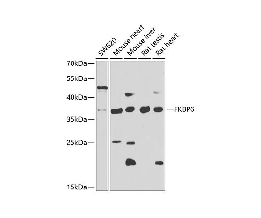 FKBP6 Rabbit pAb A7013シリーズ ABclonal 【AXEL】 アズワン