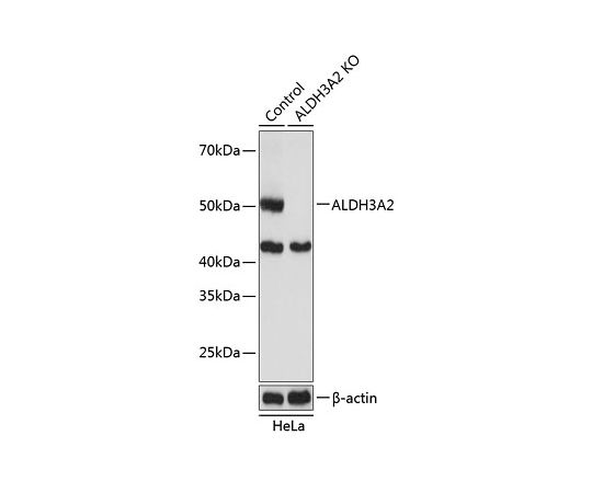 [KO Validated]ALDH3A2 Rabbit pAb A19899シリーズ ABclonal 【AXEL】 アズワン
