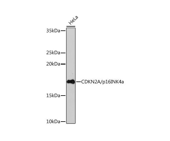[取扱を終了した商品です][KO Validated]CDKN2A/p16INK4a Rabbit mAb A5025シリーズ ABclonal 【AXEL】 アズワン