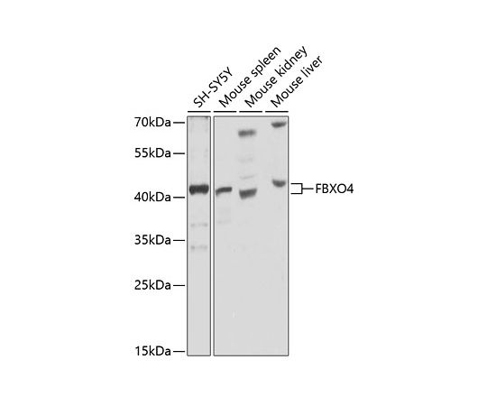 64-7625-46 FBXO4 Rabbit pAb 100uL A9968 【AXEL】 アズワン