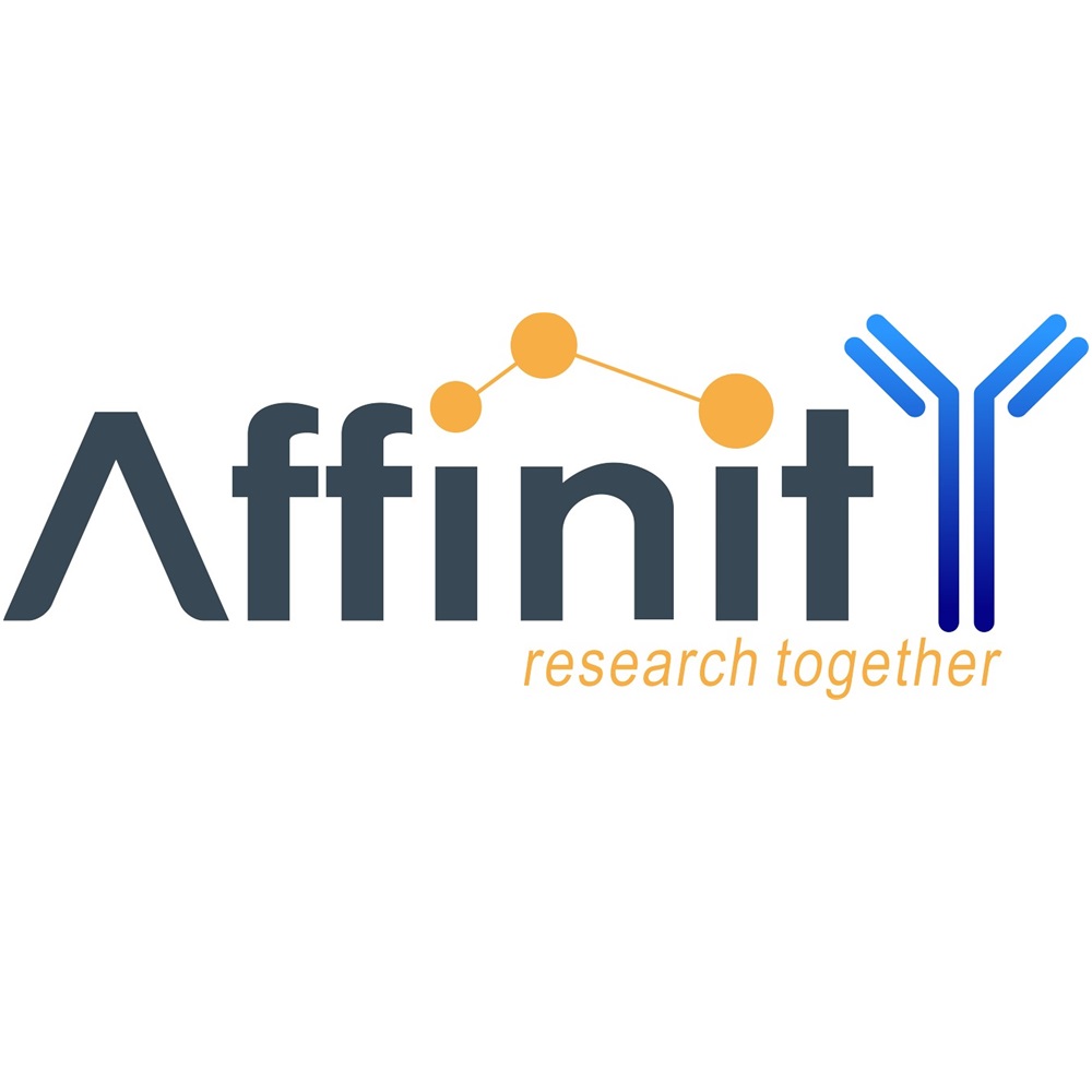 RORB Antibody DF15418シリーズ Affinity Biosciences 【AXEL】 アズワン
