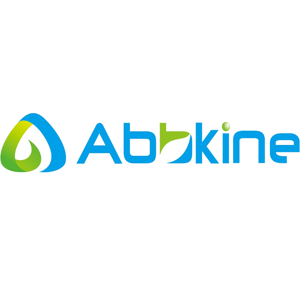 85-1199-21 Human Complement factor H-related protein 1 （CFHR1） ELISA ...