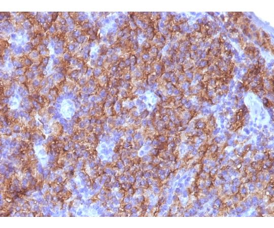 85-1221-43 Chromogranin A / CHGA （Neuroendocrine Marker） 100ug 1113 ...