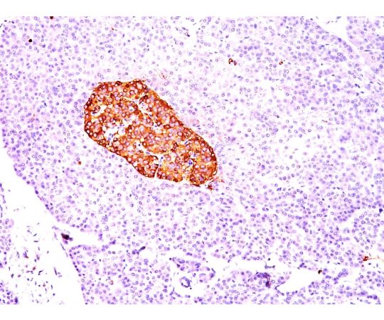Chromogranin A / CHGA（Neuroendocrine Marker） 1113シリーズ ...