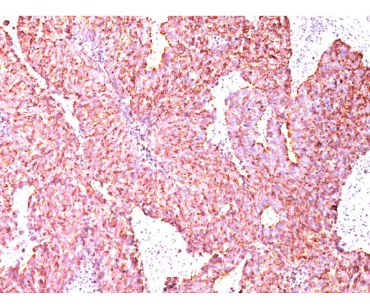85-1221-49 Chromogranin A / CHGA （Neuroendocrine Marker） 100ug 1113 ...