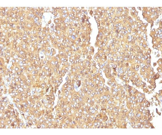 85-1221-52 Chromogranin A / CHGA （Neuroendocrine Marker） 100ug 1113 ...