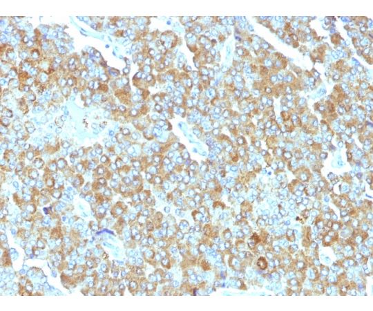 85-1221-57 Chromogranin A / CHGA （Neuroendocrine Marker） 20ug 1113-MSM3 ...
