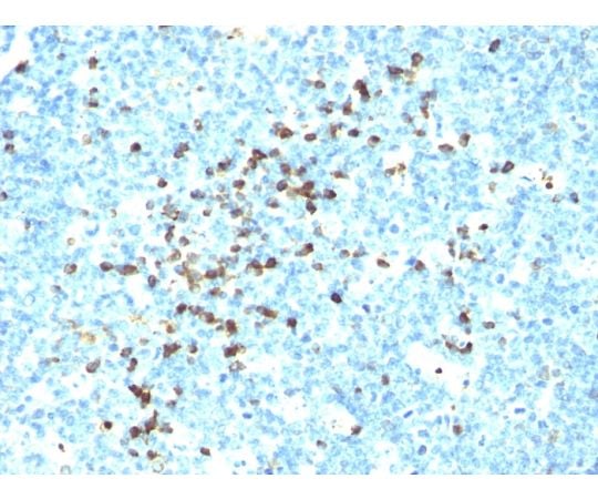 85-1227-19 IgM （Immunoglobulin Mu Heavy Chain） （B-Cell Marker） 100ug ...