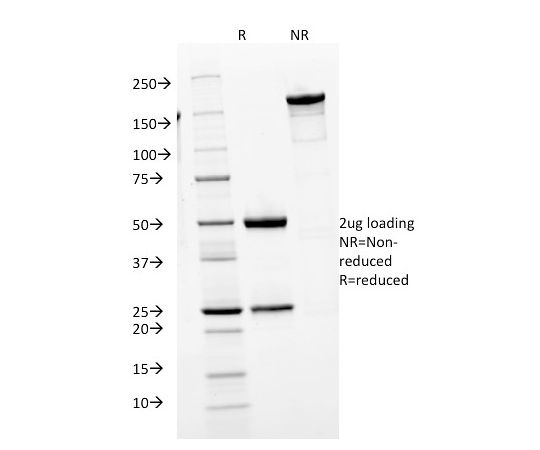 85-1227-25 IgM （Immunoglobulin Mu Heavy Chain） （B-Cell Marker） 100ug ...