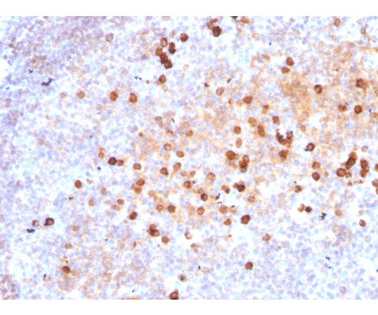 85-1227-28 IgM （Immunoglobulin Mu Heavy Chain） （B-Cell Marker） 100ug ...