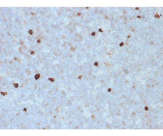 85-1227-35 IgM （Immunoglobulin Mu Heavy Chain） （B-Cell Marker） 100ug ...