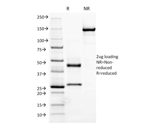 85-1227-35 IgM （Immunoglobulin Mu Heavy Chain） （B-Cell Marker） 100ug ...