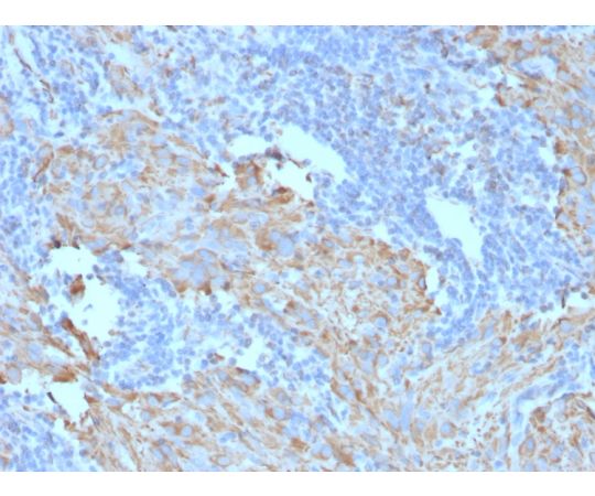 CD117 / c-Kit（Marker for Gastrointestinal Stromal Tumors） 3815-MSMシリーズ ...