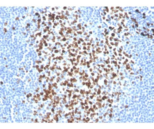 85-1229-89 Ki-67 （Proliferating Cell Marker） 0.5mlat100ug/ml 4288-MSM5 ...