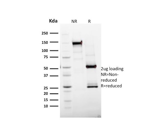 85-1229-89 Ki-67 （Proliferating Cell Marker） 0.5mlat100ug/ml 4288-MSM5 ...