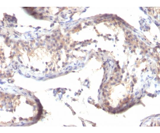 85-1237-04 TGF-alpha （Transforming Growth Factor alpha） 100ug 7039-MSM1 ...