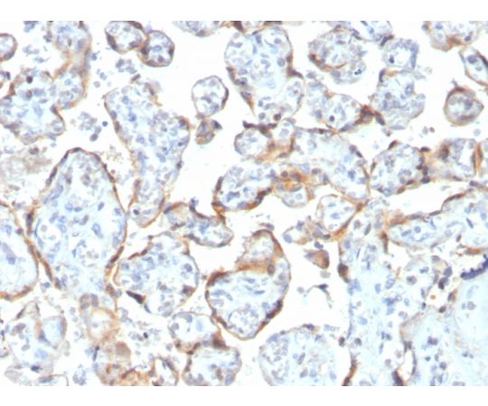 TIMP2（Tissue Inhibitor of Metalloproteinase 2） 7077シリーズ ...