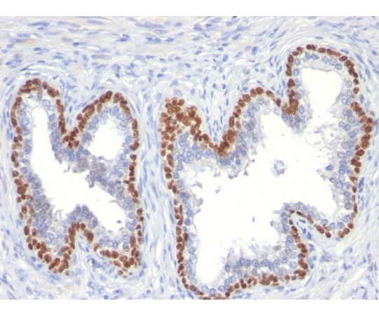p63（Squamous, Basal ＆ Myoepithelial Cell Marker） 8626シリーズ ...