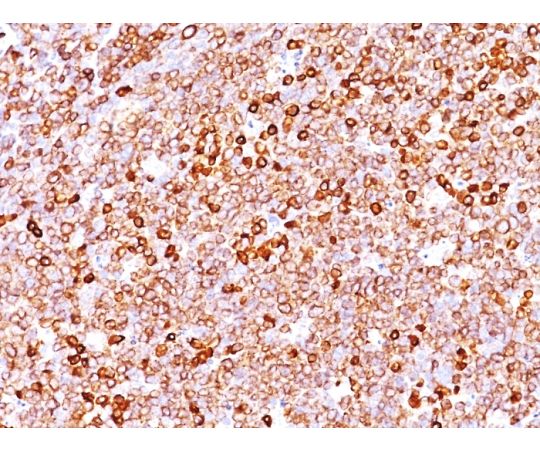 CD79a（B Cell Marker） 973-MSMシリーズ NeoBiotechnologies 【AXEL】 アズワン