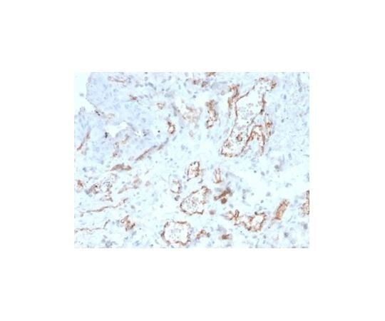 85-1260-60 CD31 / PECAM-1 （Endothelial Cell Marker） 100ug 5175-MSM31-P1 ...