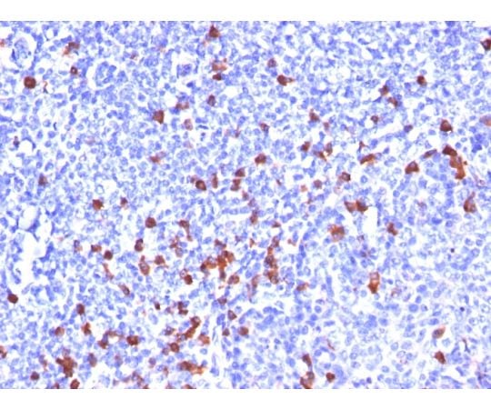 85-1261-01 IgG （Immunoglobulin Gamma Heavy Chain） （B Cell Marker） 100ug ...