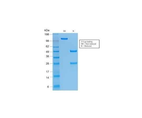 85-1261-04 CD61 / Integrin ＆beta;3 / Platelet Glycoprotein IIIa ...