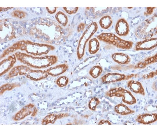 85-1261-04 CD61 / Integrin ＆beta;3 / Platelet Glycoprotein IIIa ...