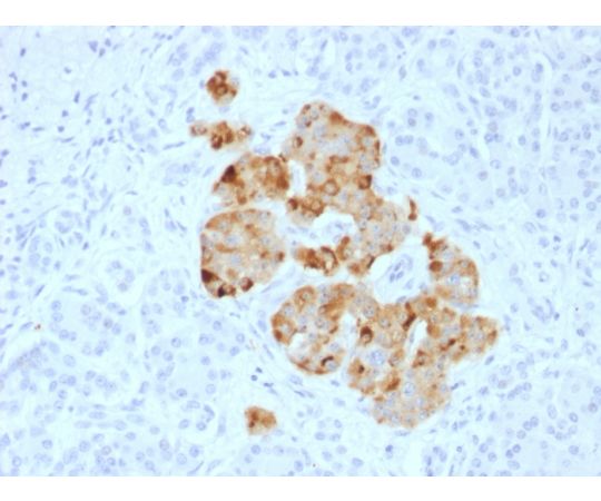 85-1266-02 Chromogranin A / CHGA （Neuroendocrine Marker） 100ug 1113 ...