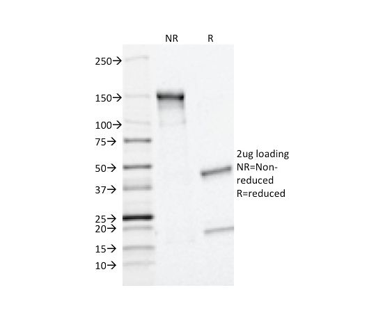 MRP1 / ABCC1（Multidrug Resistance Related Protein 1） 4363-MSMシリーズ ...
