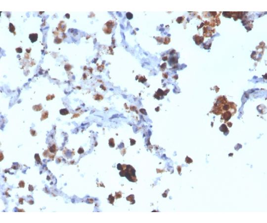 85-1270-94 Napsin A （Lung Adenocarcinoma Marker） 20ug 9476-MSM10-P0 ...