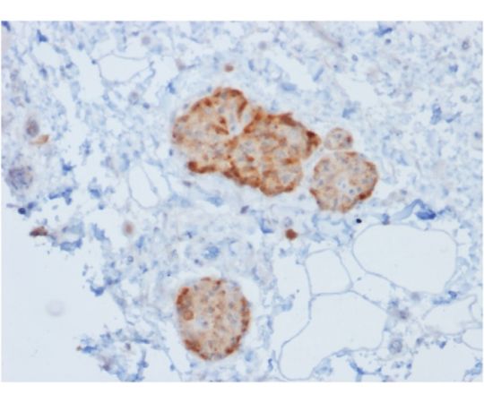 85-1275-18 Chromogranin A / CHGA （Neuroendocrine Marker） 100ug 1113 ...