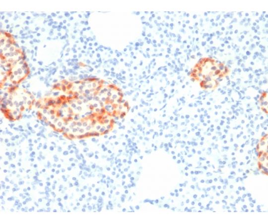85-1277-99 Chromogranin A / CHGA （Neuroendocrine Marker） 100ug 1113 ...