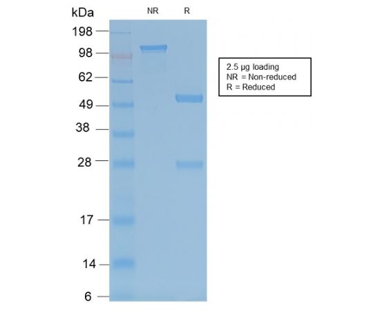 85-1280-21 TRAcP （Tartrate-Resistant Acid Phosphatase） （Hairy Cell ...