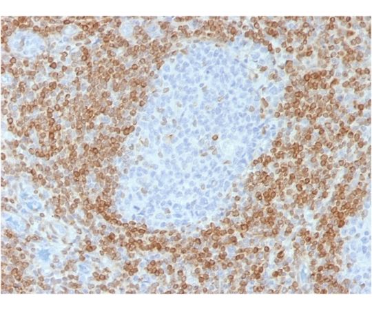 Bcl-2（Apoptosis＆ Follicular Lymphoma Marker） 596シリーズ NeoBiotechnologies ...