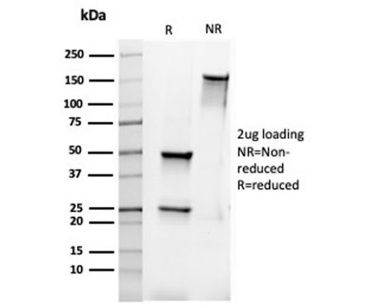 85-1280-94 Bcl-2（Apoptosis＆ Follicular Lymphoma Marker） 20ug 596-MSM14 ...