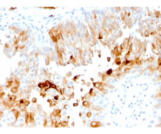 Uroplakin 1A（Urothelial Differentiation Marker） 11045-MSMシリーズ ...
