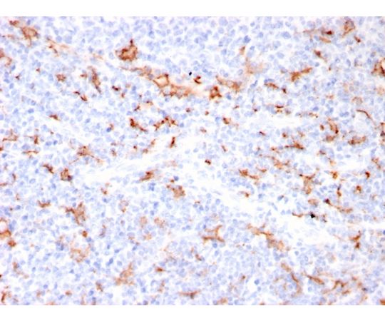 S100A9 + Calprotectin（S100A8/A9 Complex） 6279-RBM5-Pシリーズ ...