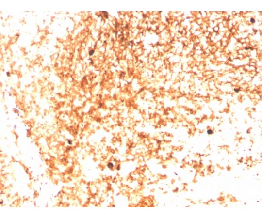 85-1288-02 IgM （Immunoglobulin Mu Heavy Chain） （B-Cell Marker） 100ug ...